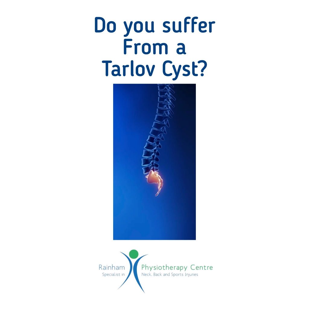 Do you suffer from a Tarlov Cyst? – Rainham Physio